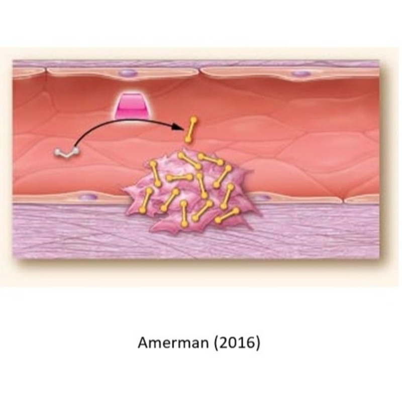 Hemostasis Free Sheet Music By Crowther For Small Ensemble Noteflight